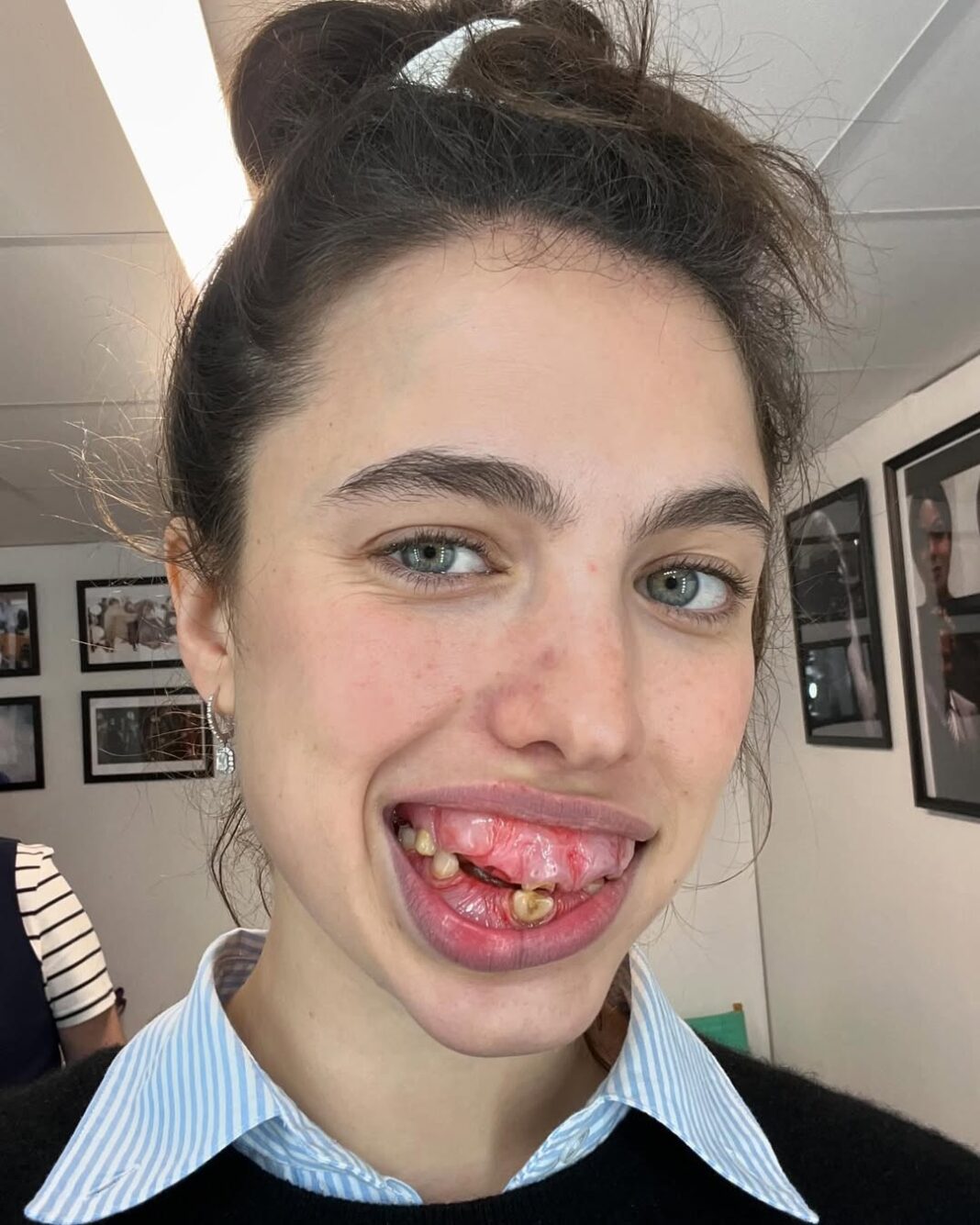 Margaret Qualley tardó un año en recuperarse de las prótesis que usó en ...